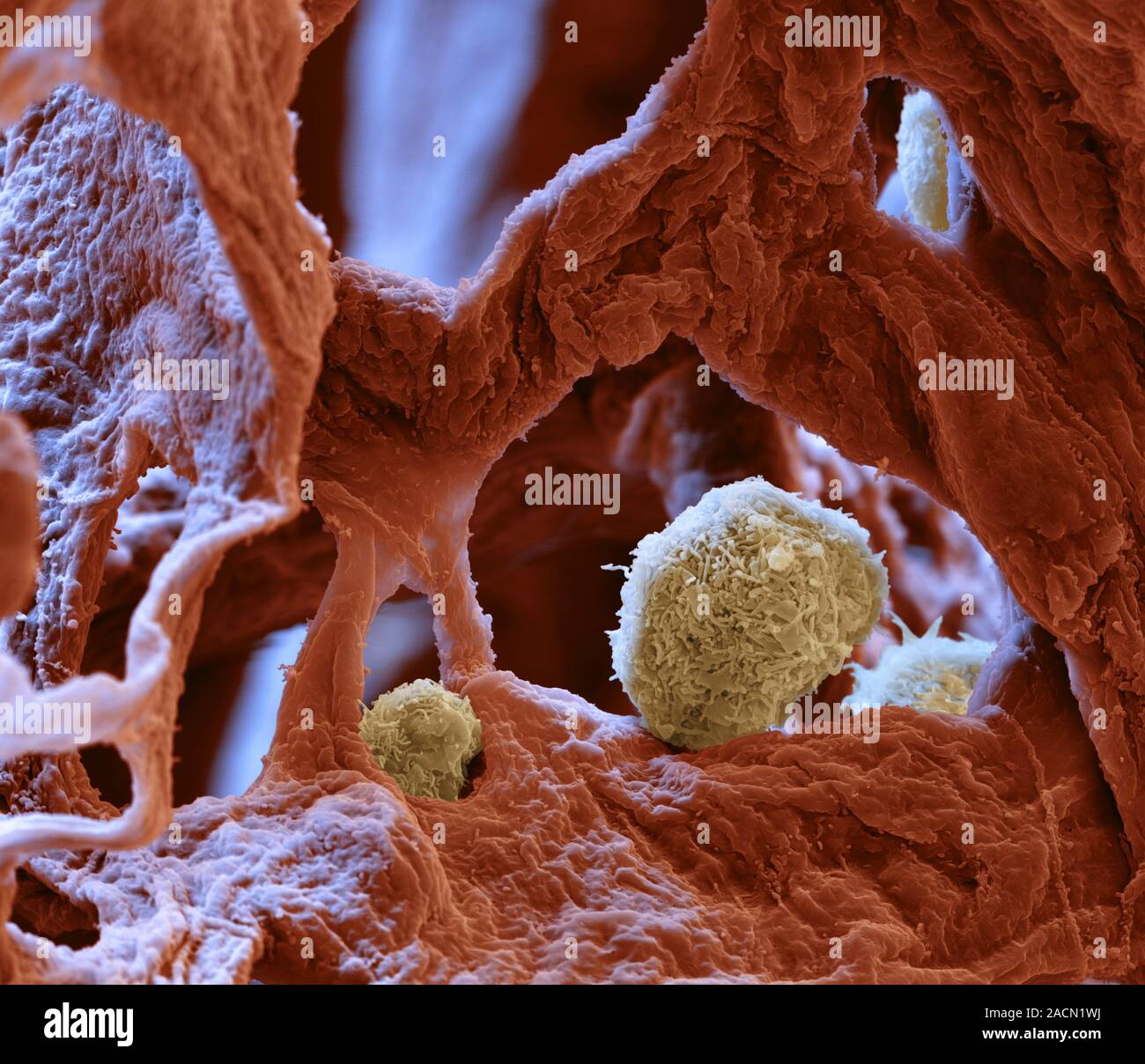 Alveolar macrophages. Coloured scanning electron micrograph (SEM) of ...