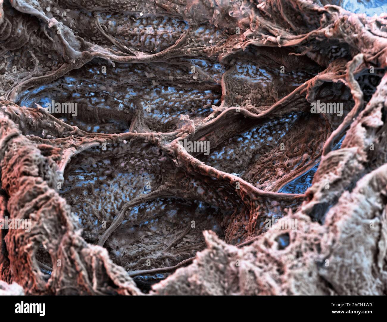 Lung tissue. Coloured scanning electron micrograph (SEM) of a section ...