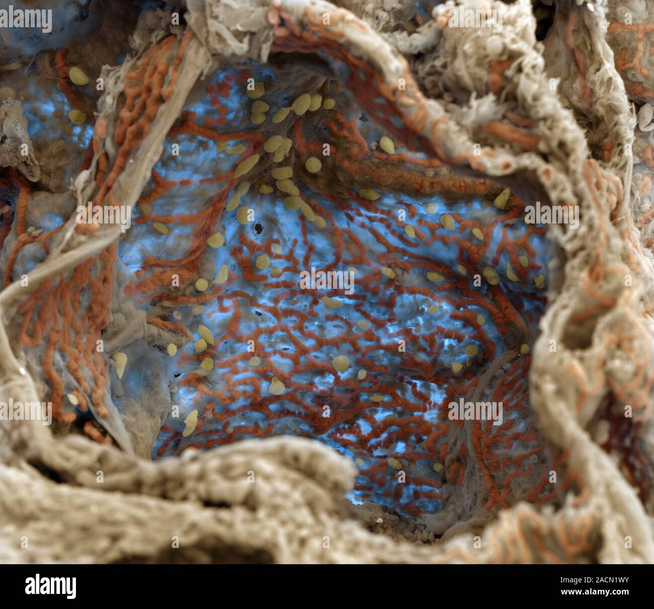 Lung tissue. Coloured scanning electron micrograph (SEM) of a section ...