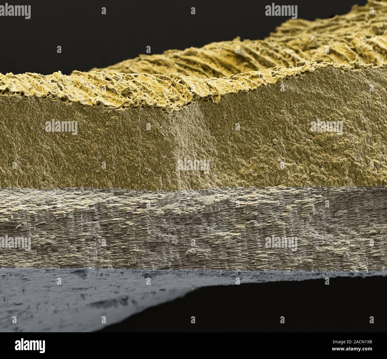 Abalone shell. Coloured scanning electron micrograph (SEM) of a section ...