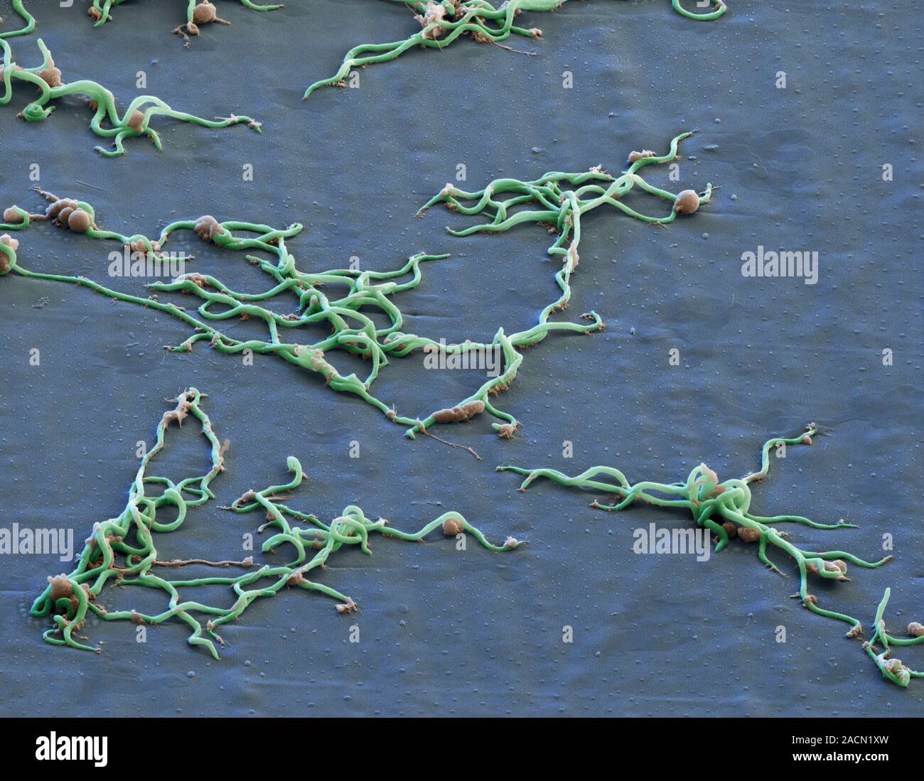 Lyme disease bacteria. Coloured scanning electron micrograph (SEM) of ...