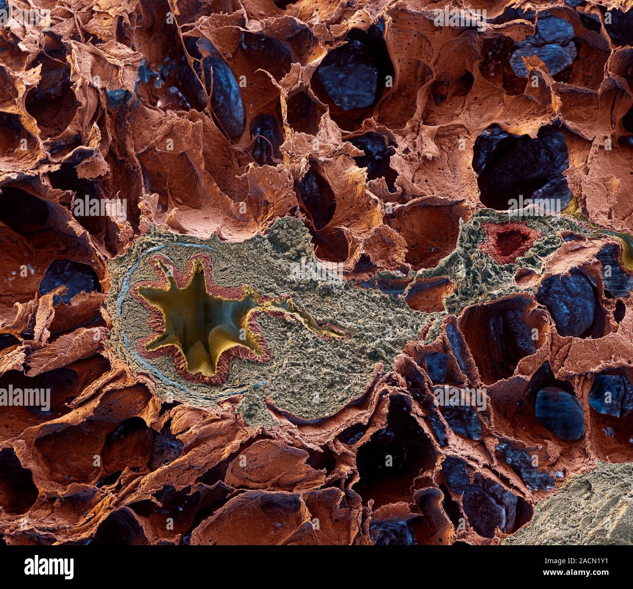 Lung tissue. Coloured scanning electron micrograph (SEM) of a section ...