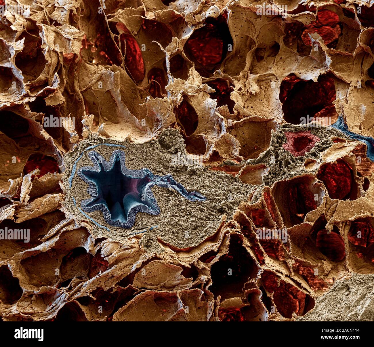 Lung tissue. Coloured scanning electron micrograph (SEM) of a section ...