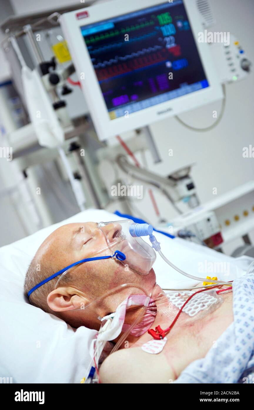 Intensive care patient. Face of a male patient in the intensive care ...