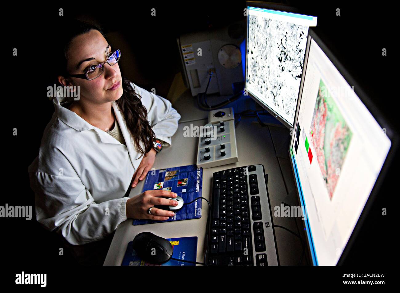 Pathologist using a low vacuum scanning electron microscope to look at ...