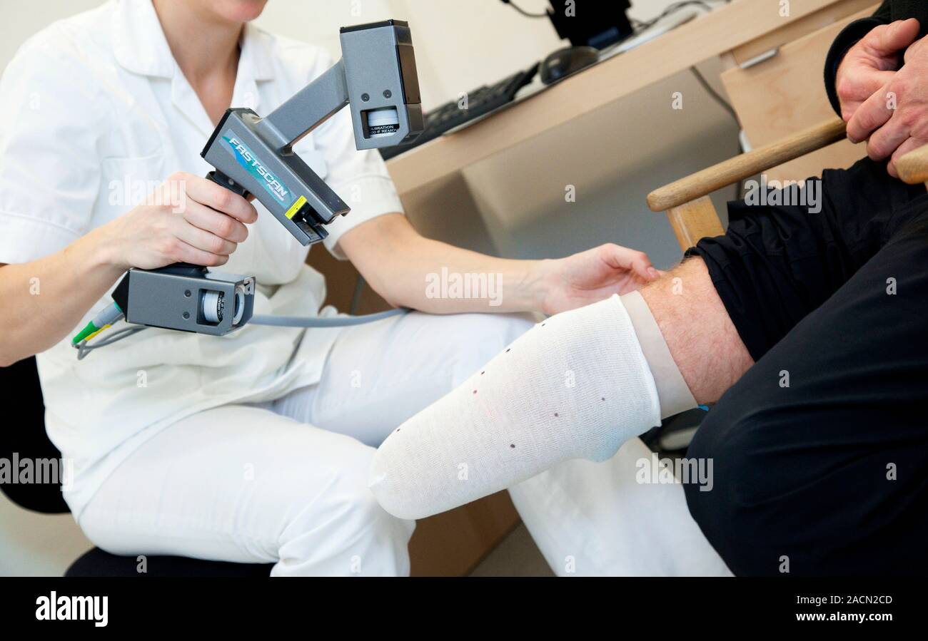 Orthopaedic technician scanning an amputee using polhemus fastSCAN ...