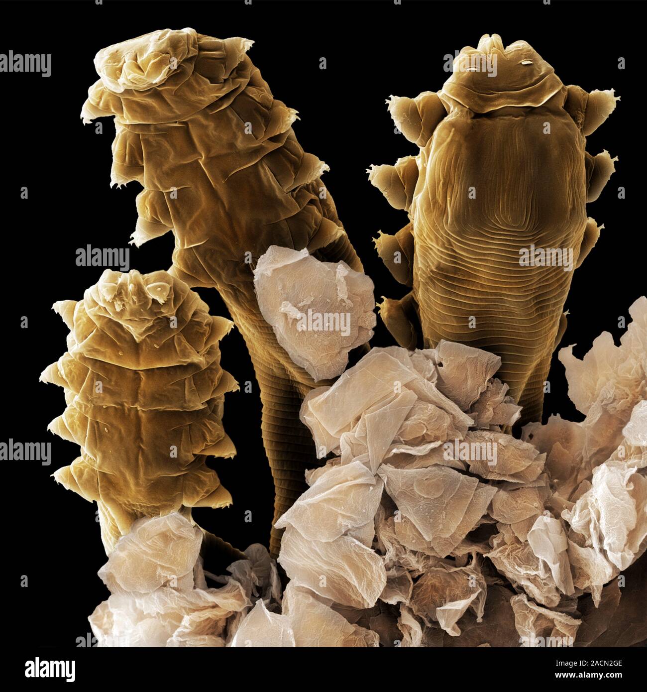 Follicle mite heads (Demodex folliculorum), coloured scanning electron ...