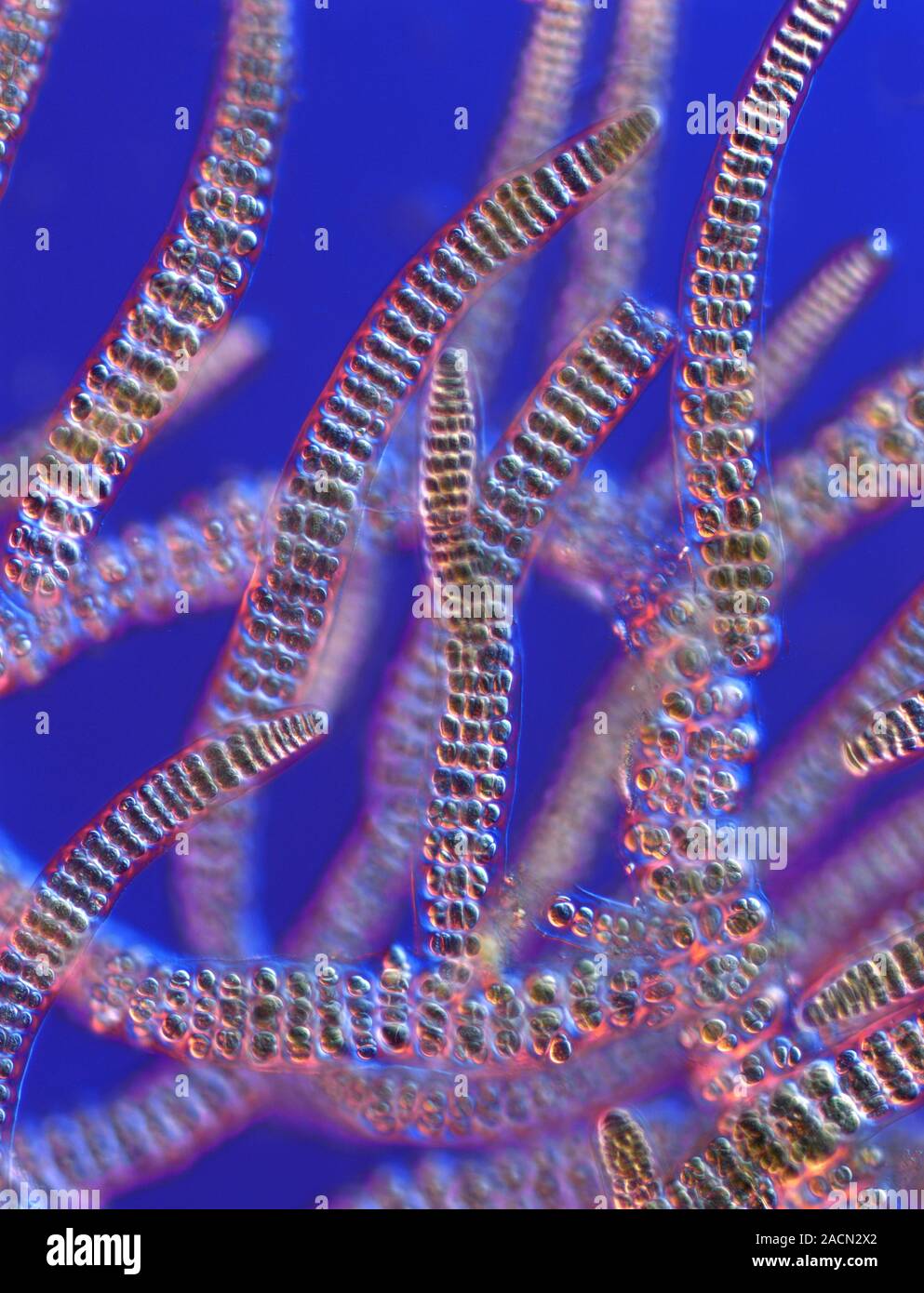 Light micrograph using differential interference contrast microscopy ...