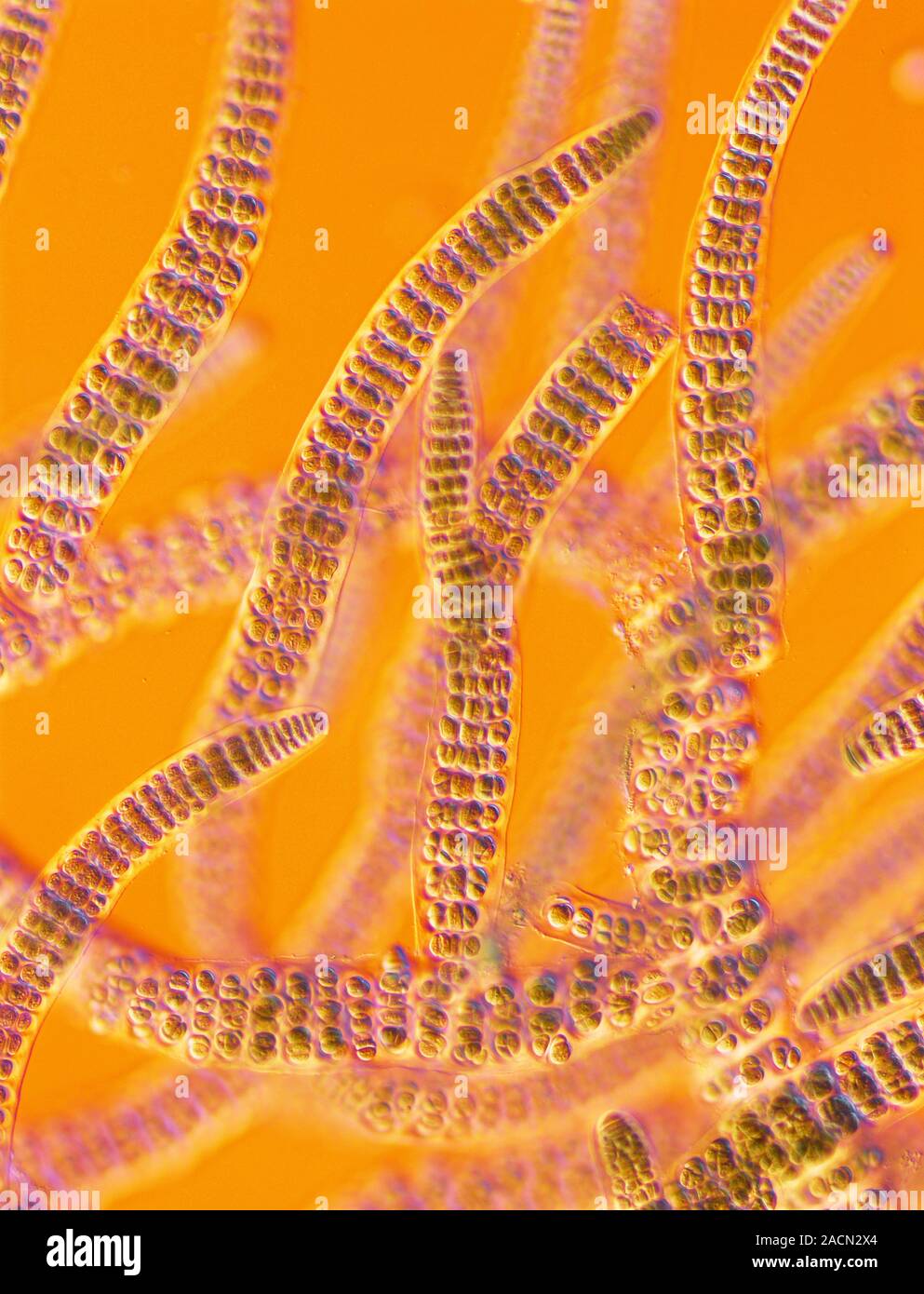 Light micrograph using differential interference contrast microscopy ...