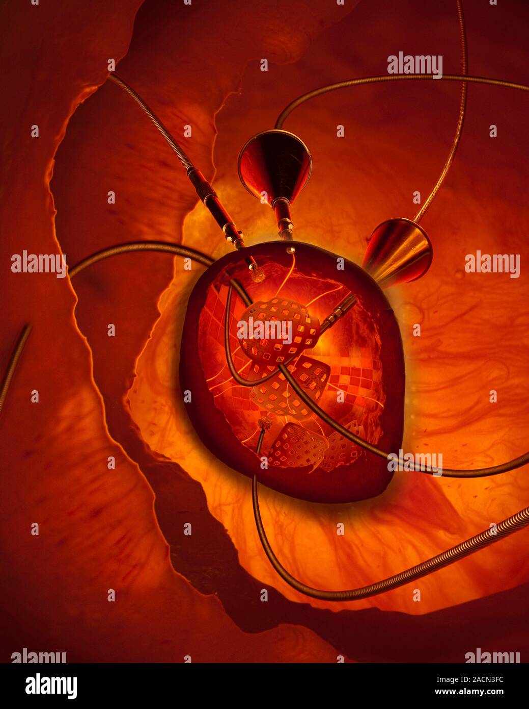 Micro-robotic surgery, conceptual image. Computer artwork representing ...