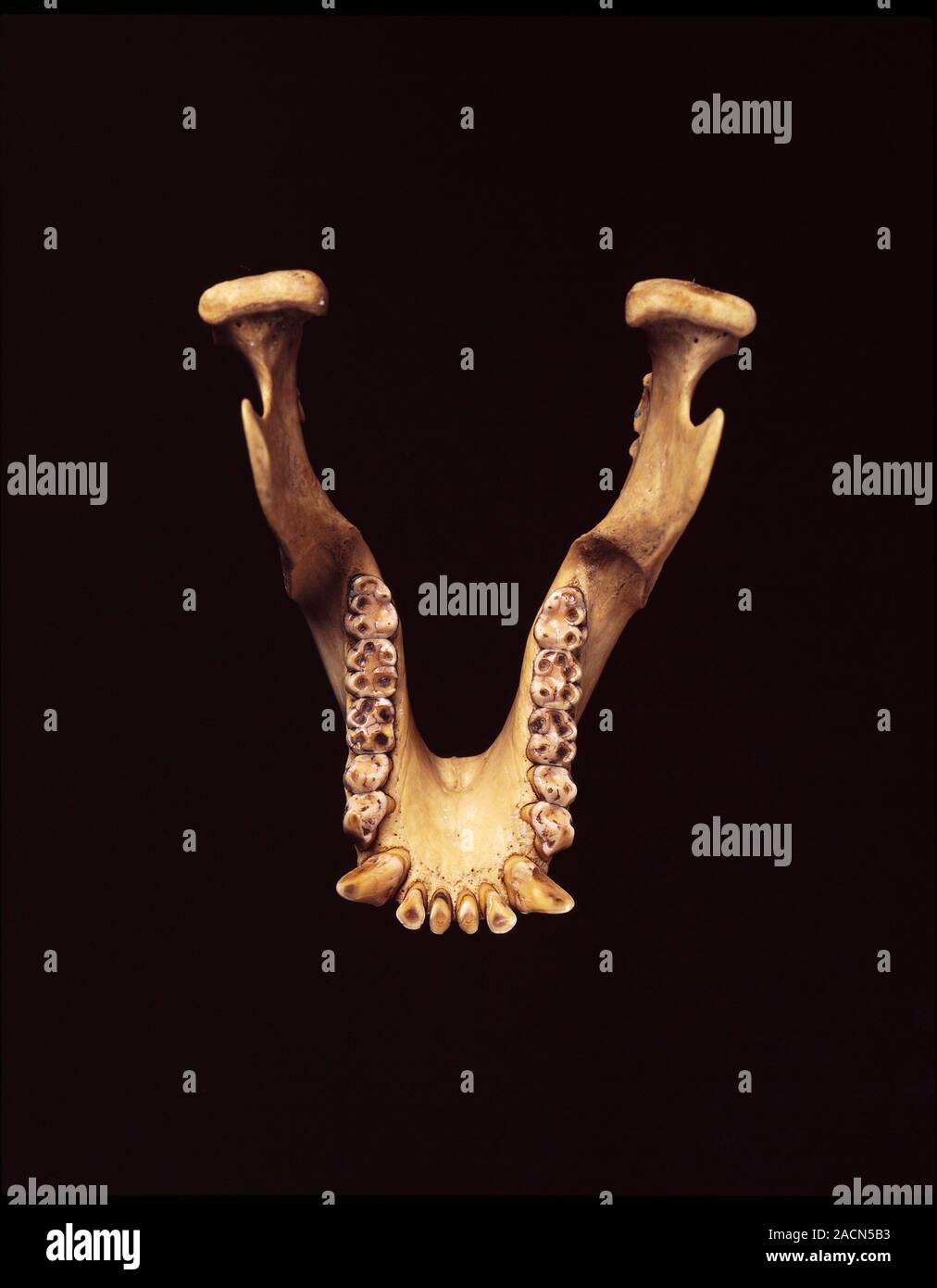 Paranthropus robustus mandible (lower jaw). Also known as ...
