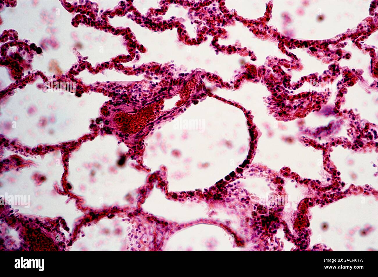 Healthy lung tissue. Light micrograph of a section through healthy lung ...
