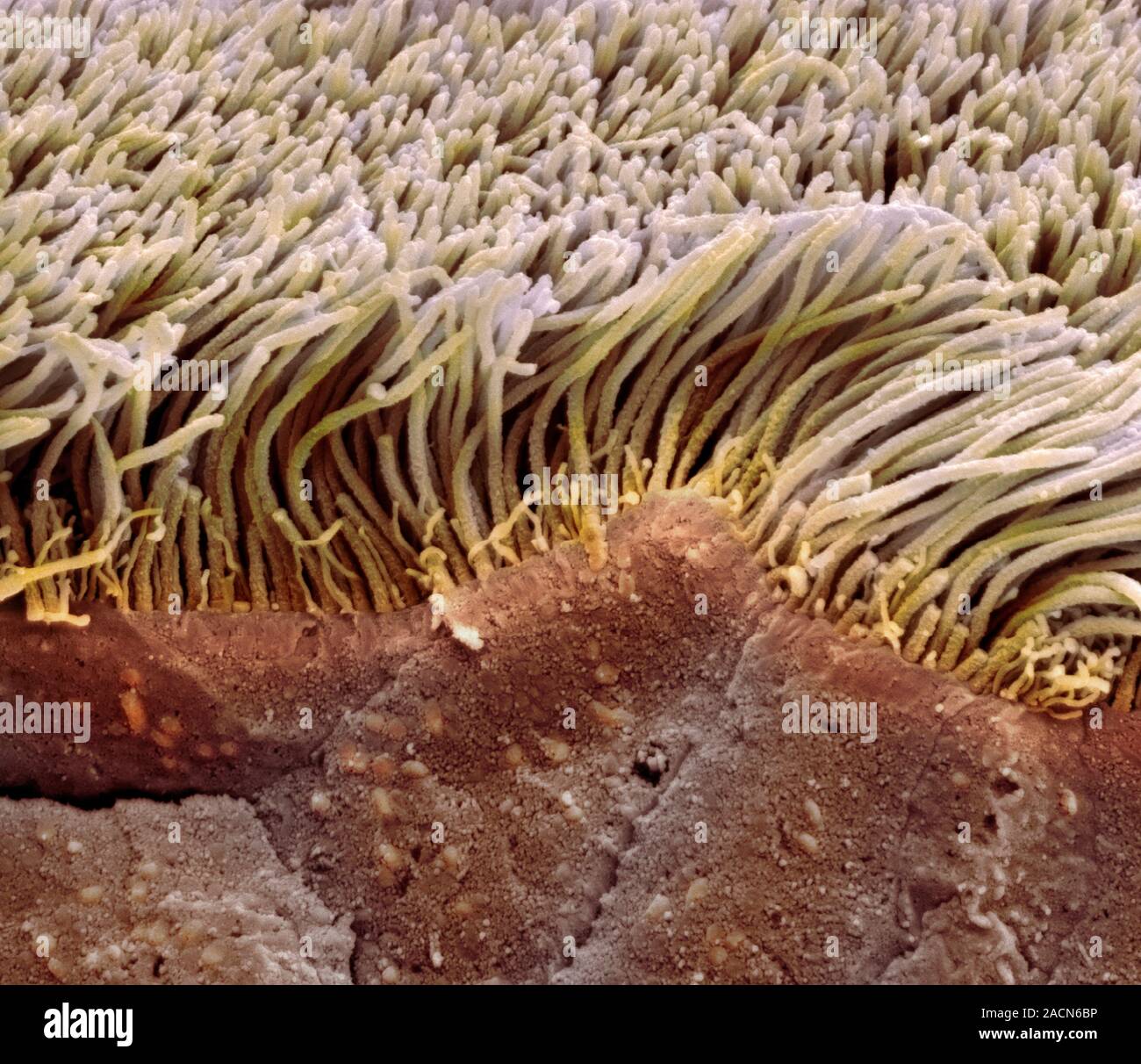 Trachea lining. Coloured scanning electron micrograph (SEM) of a ...