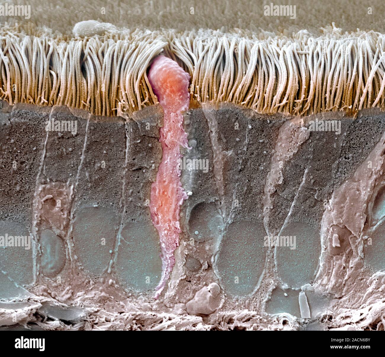 Trachea lining. Coloured scanning electron micrograph (SEM) of a ...