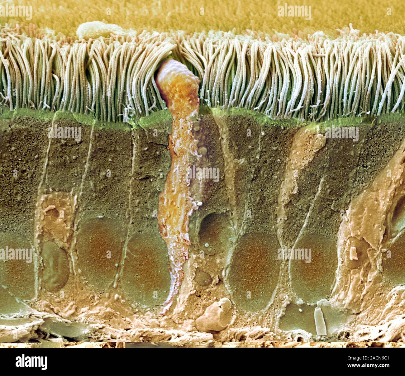 Trachea lining. Coloured scanning electron micrograph (SEM) of a ...