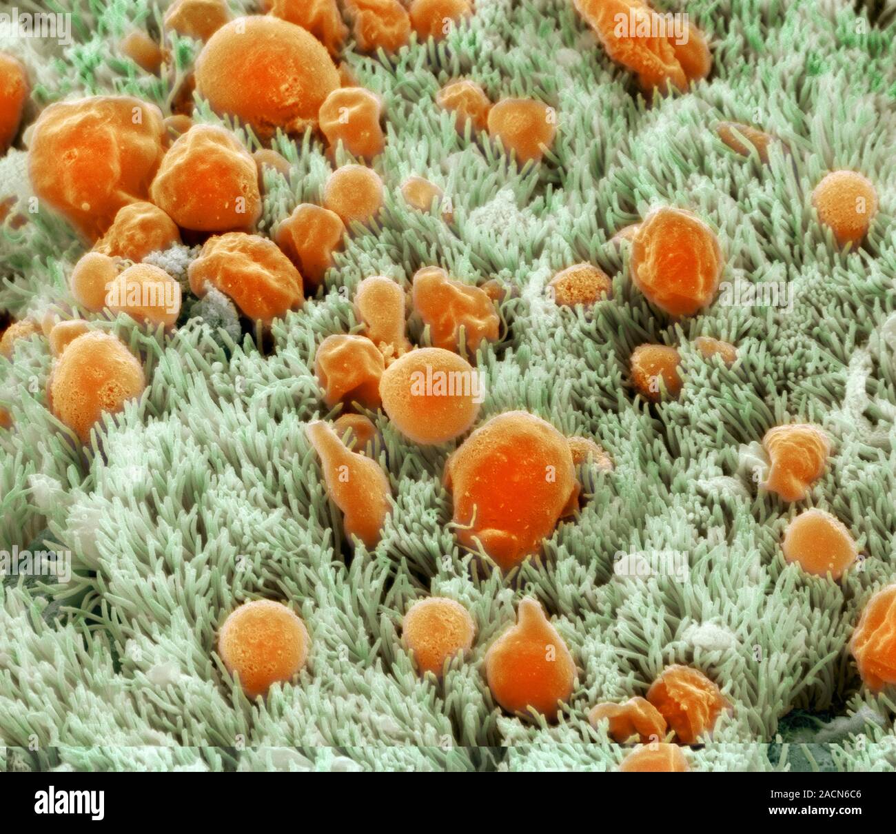 Trachea lining. Coloured scanning electron micrograph (SEM) of the ...