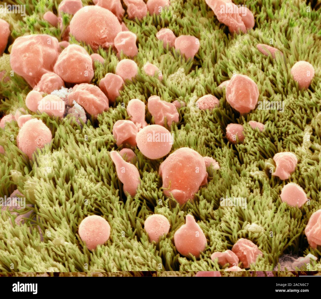 Trachea lining. Coloured scanning electron micrograph (SEM) of the ...