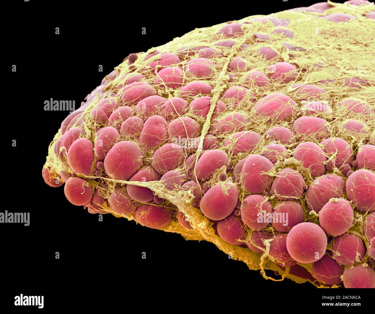 Fat tissue. Coloured scanning electron micrograph (SEM) of a sample of ...