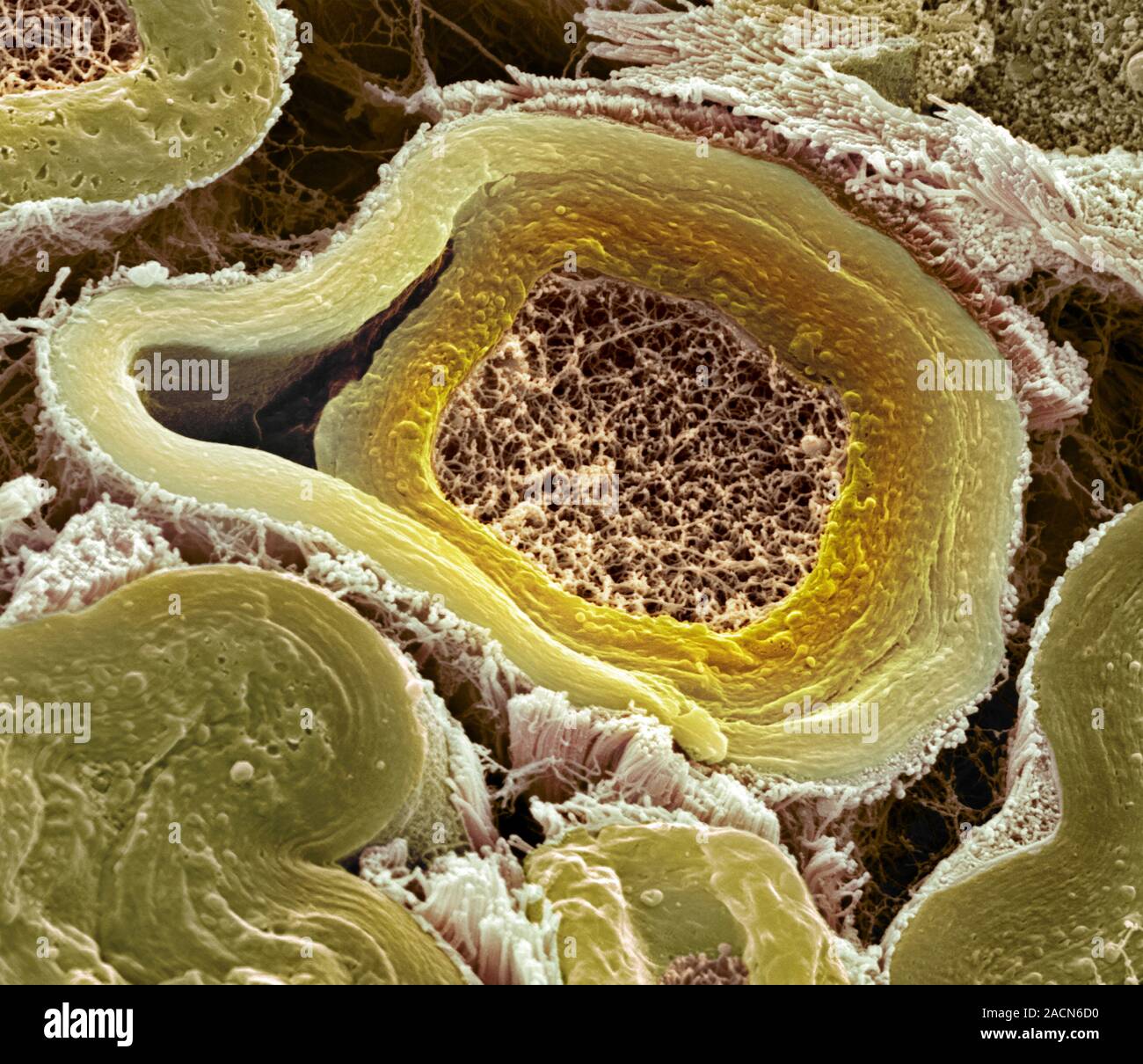 Myelinated nerves. Coloured scanning electron micrograph (SEM) of a ...