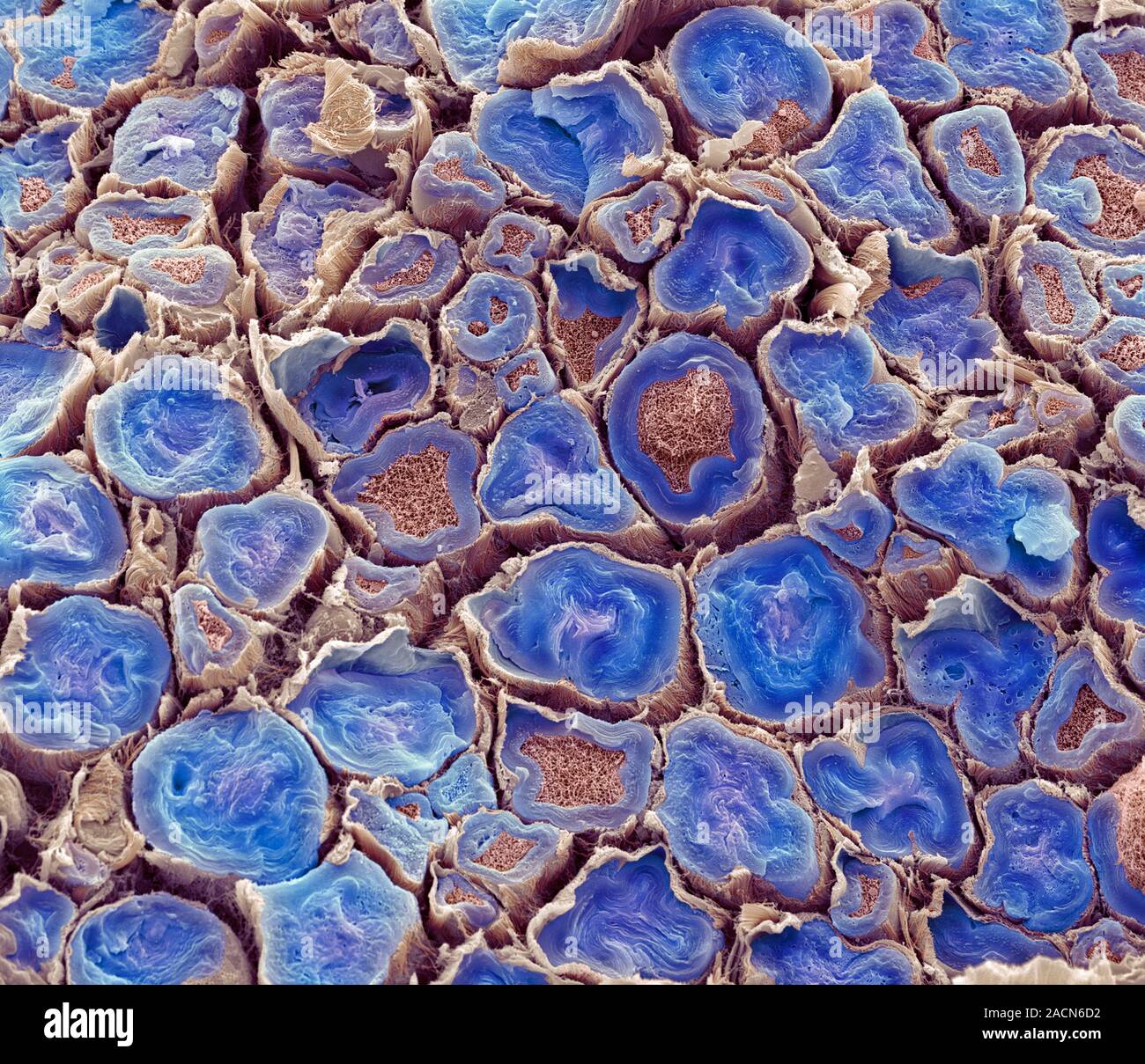 Myelinated Nerves Coloured Scanning Electron Micrograph Sem Of A Section Through The Sciatic