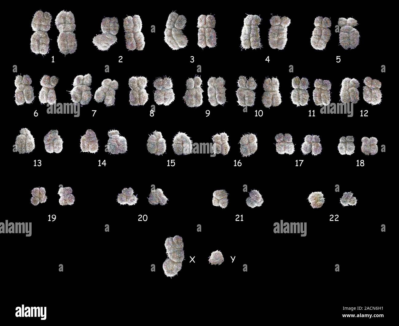 Set of human chromosomes, coloured scanning election micrograph (SEM ...