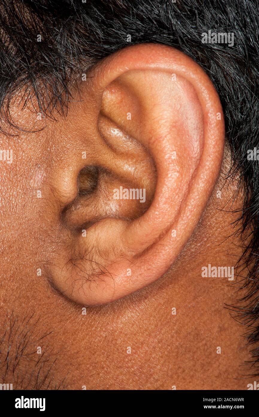 Human ear. Close-up of the ear of a 24-year-old man. The visible ...