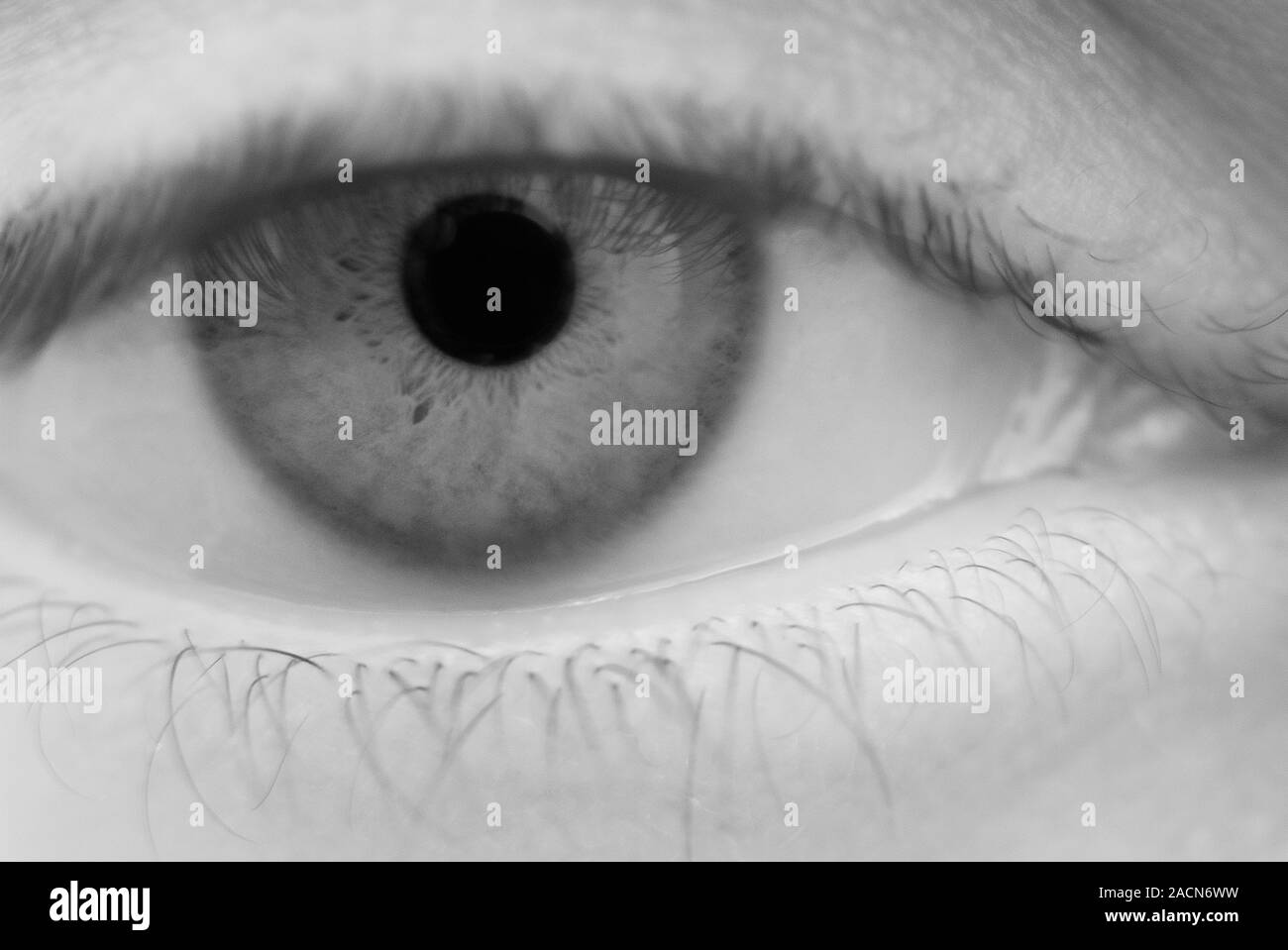 Human eye, close-up infrared image. This is the right-hand eye of a 24 ...