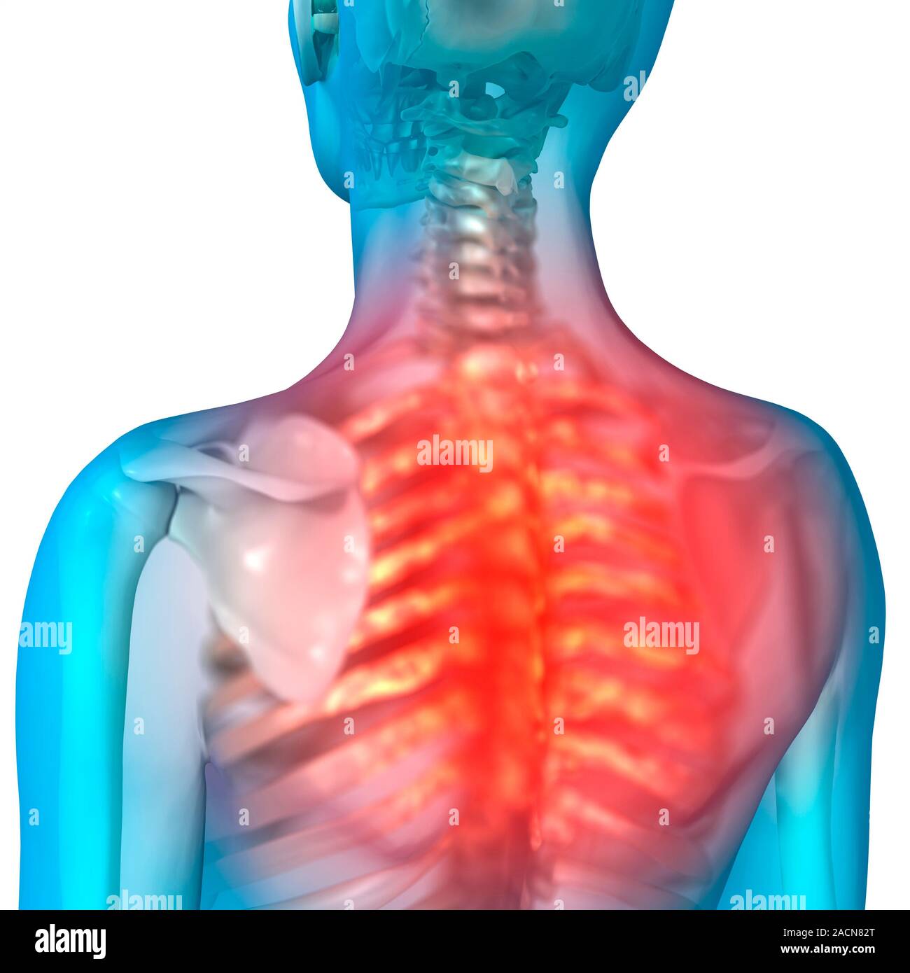Back pain, computer artwork Stock Photo - Alamy