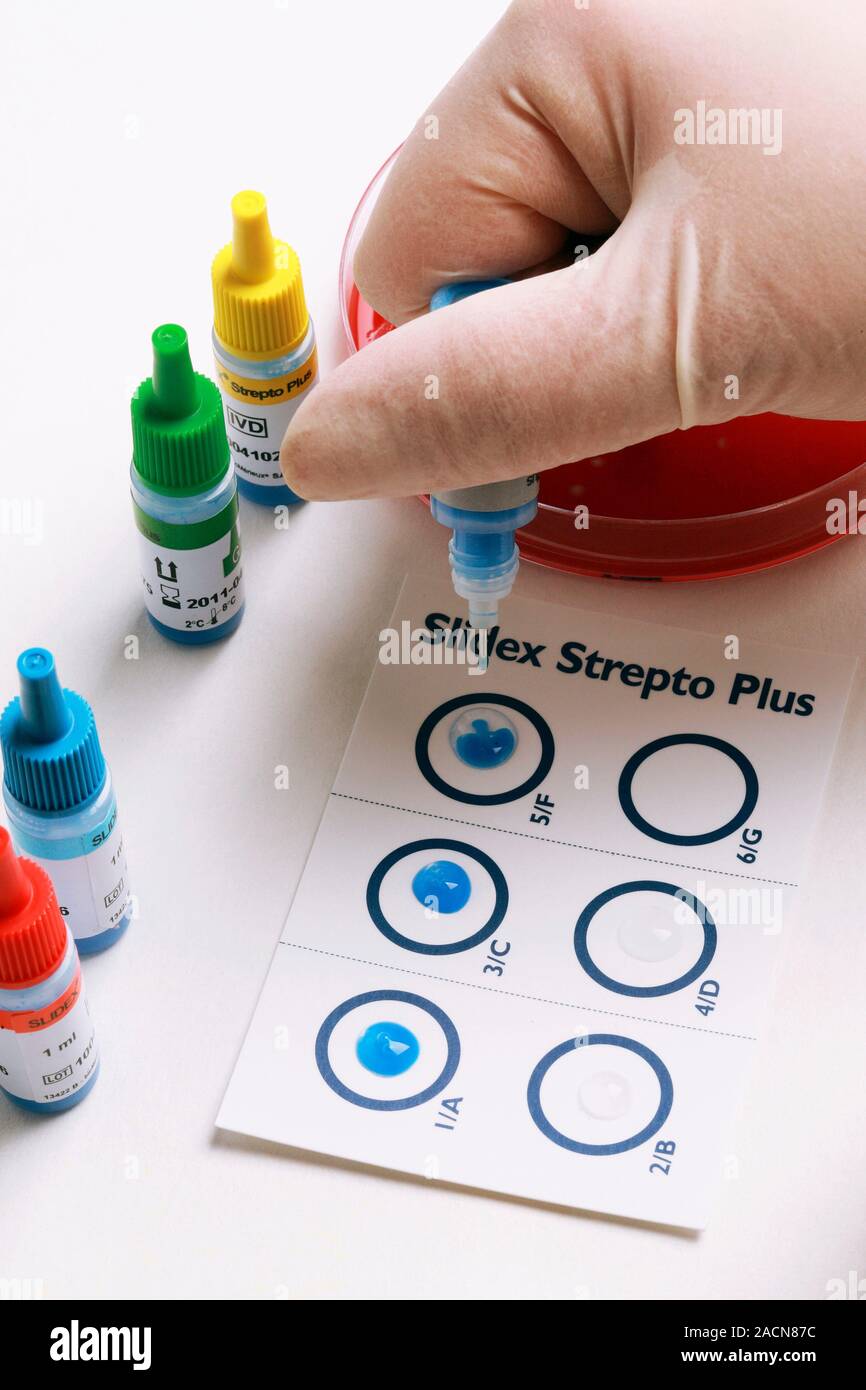 Streptococcus grouping test. This is the Streptocard acid latex test ...