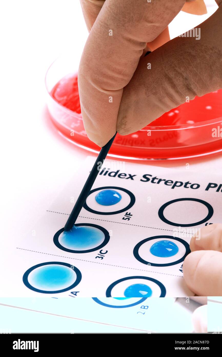 Streptococcus grouping test. This is the Streptocard acid latex test ...