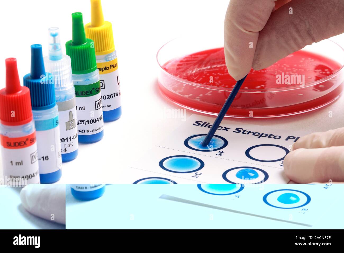 Streptococcus grouping test. This is the Streptocard acid latex test ...
