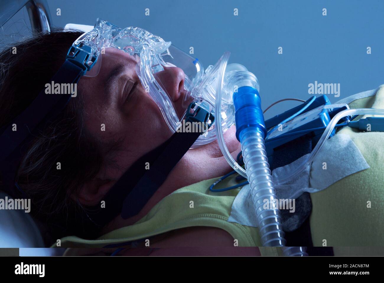 Sleep apnoea treatment. Close-up of an obese woman using a continuous ...