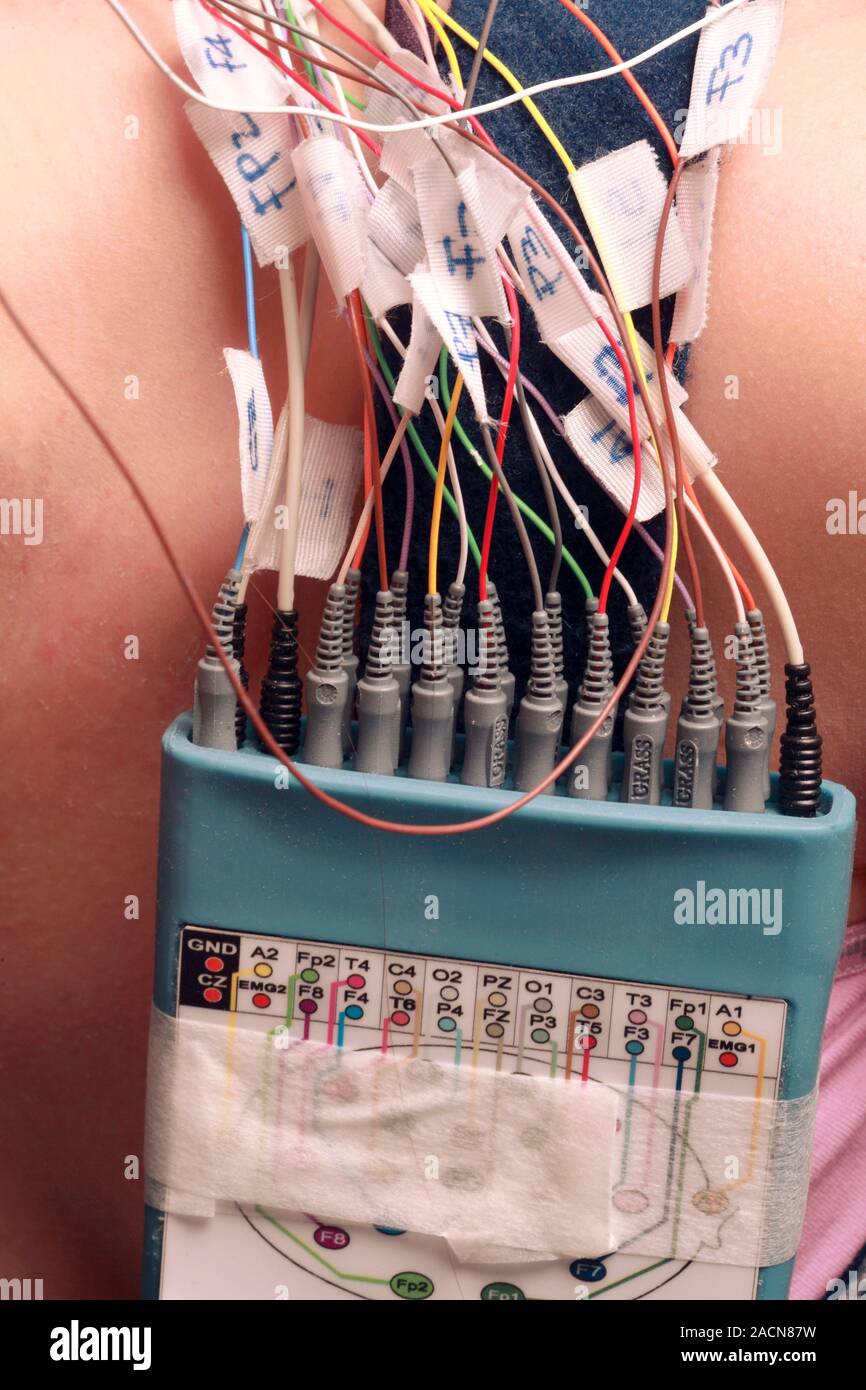 Electroencephalography (EEG) electrodes wires. The other end of these ...