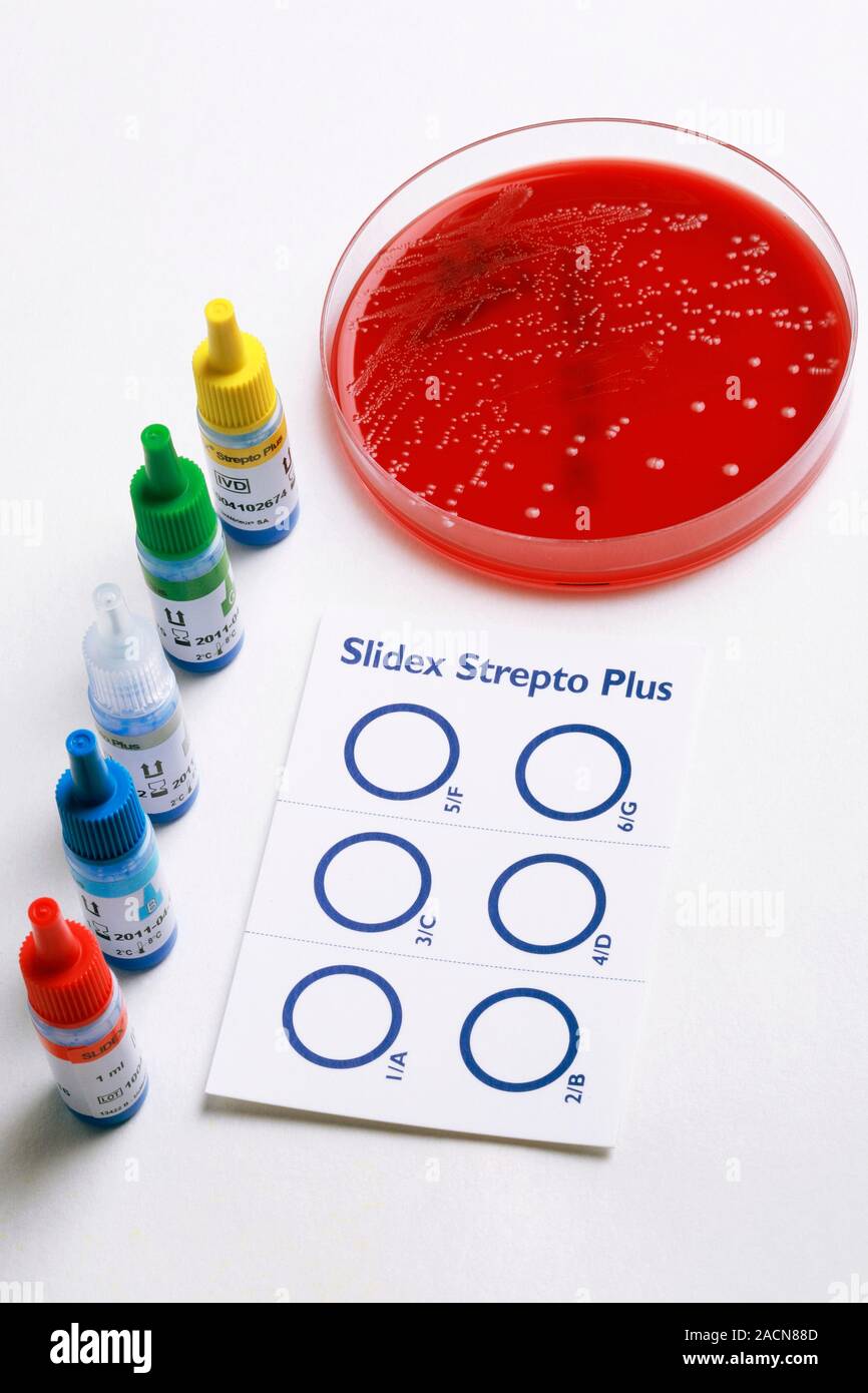 Streptococcus grouping test. This is the Streptocard acid latex test ...