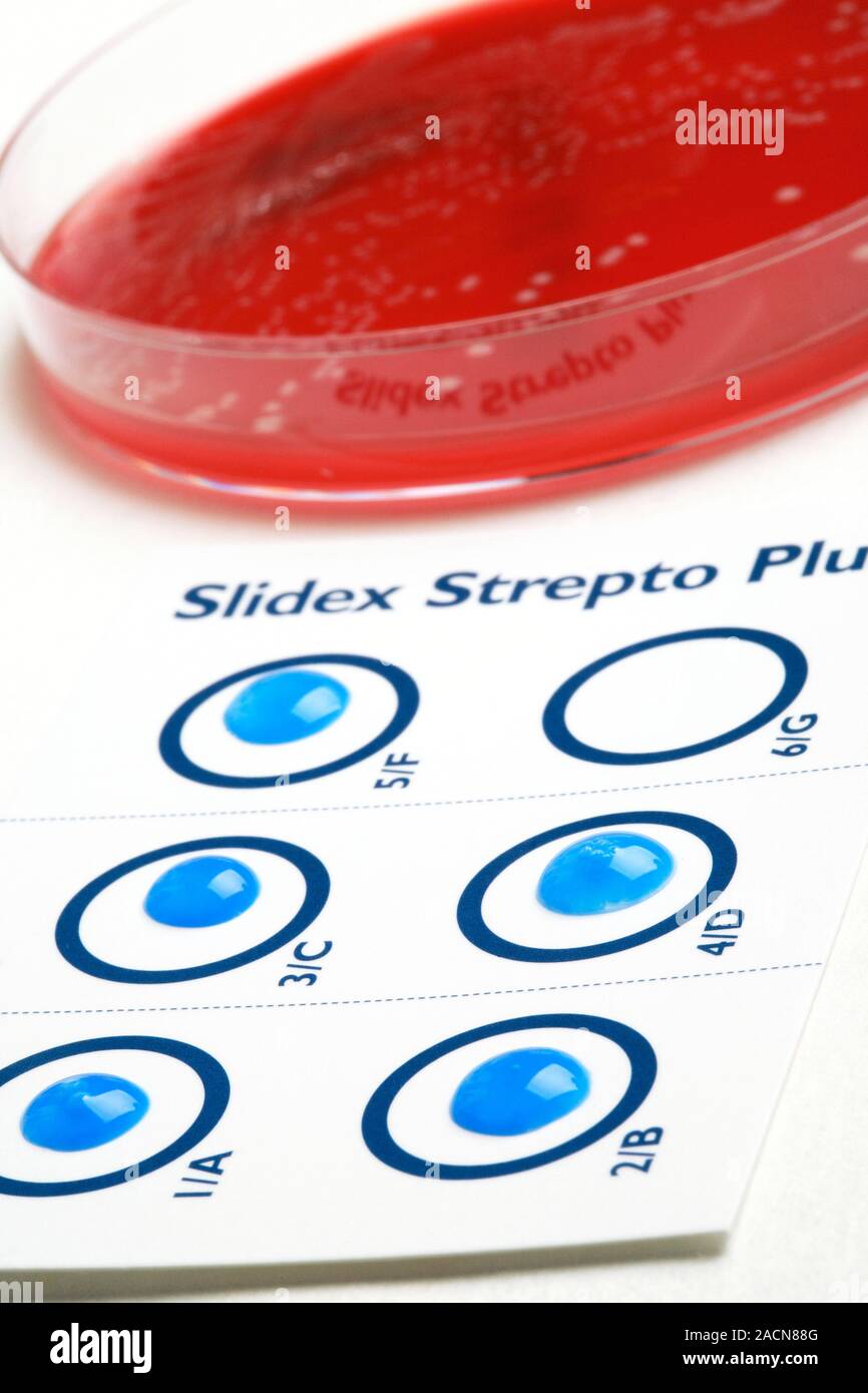 Streptococcus grouping test. This is the Streptocard acid latex test ...