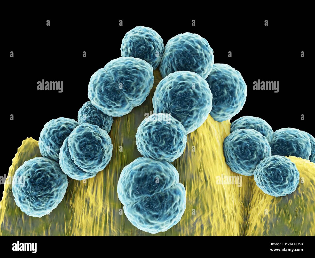 Staphylococcus aureus MRSA bacteria, computer artwork. Methicillin ...