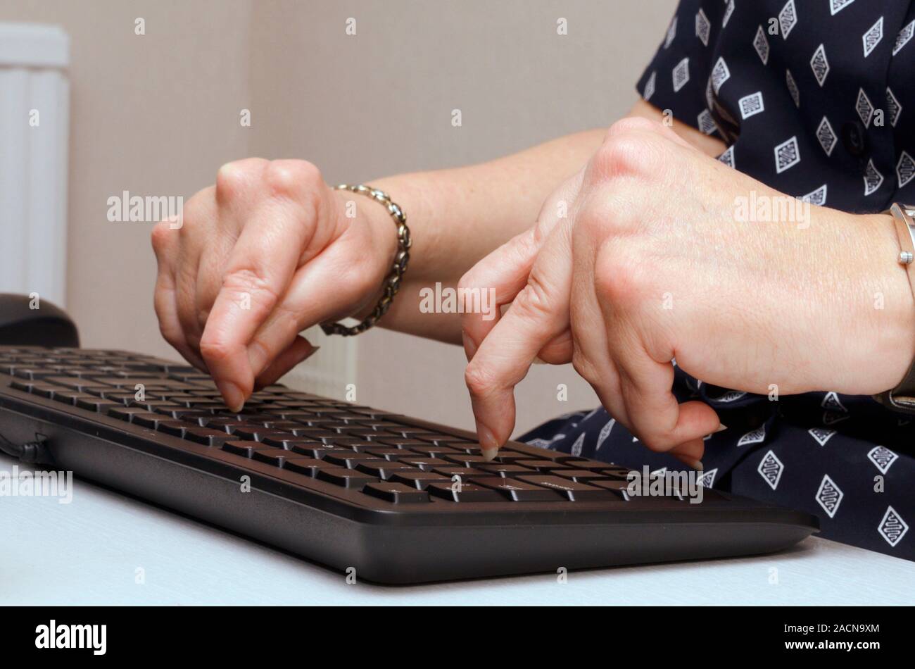 Not for use in Television Not for use in Television Rheumatoid ...