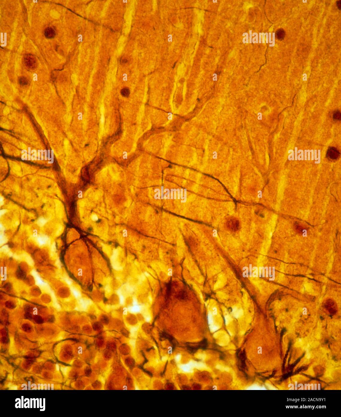 Purkinje nerve cells. Light micrograph of three purkinje nerve cells ...