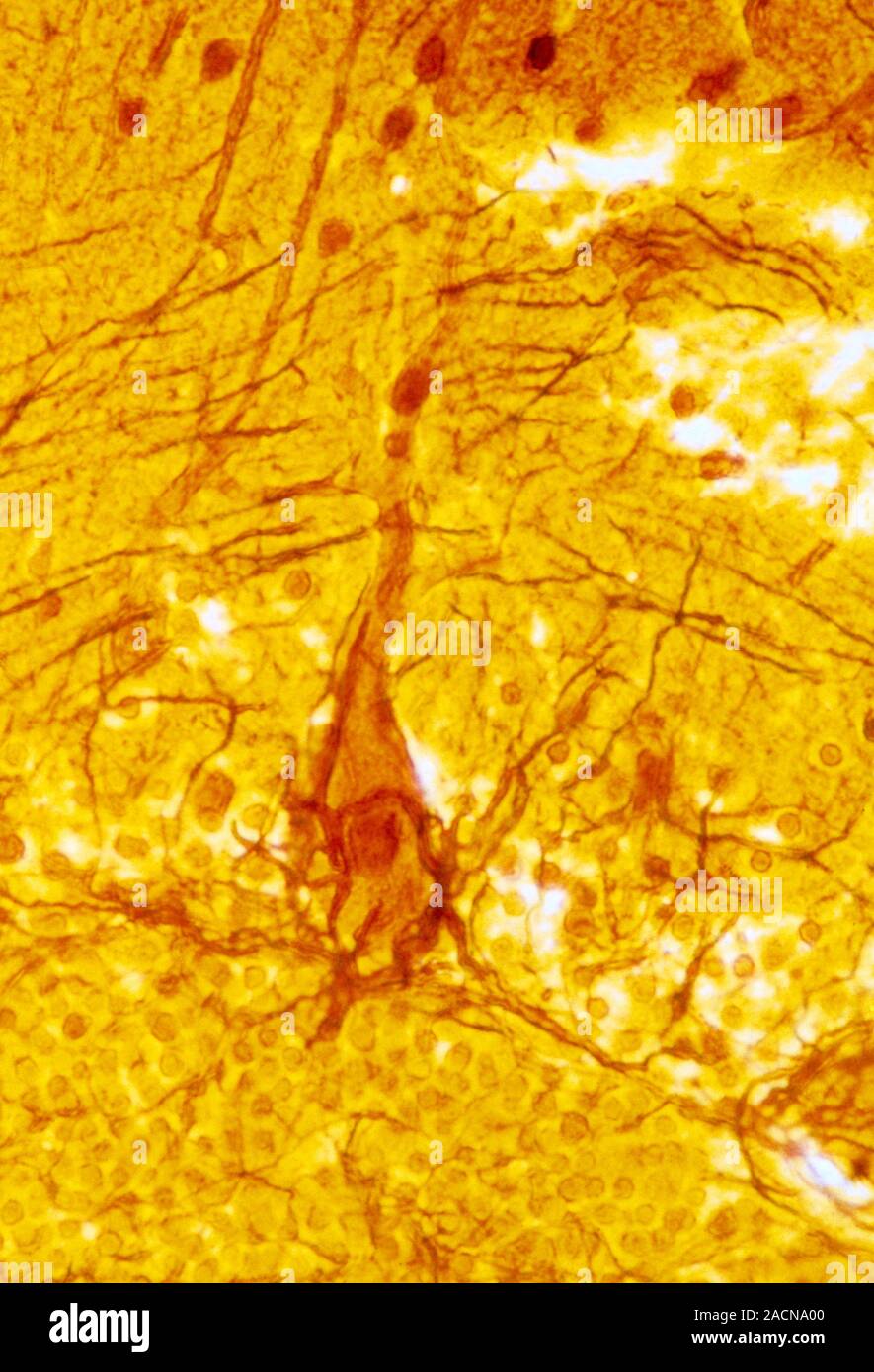 Purkinje nerve cell. Light micrograph of a purkinje nerve cell (orange ...