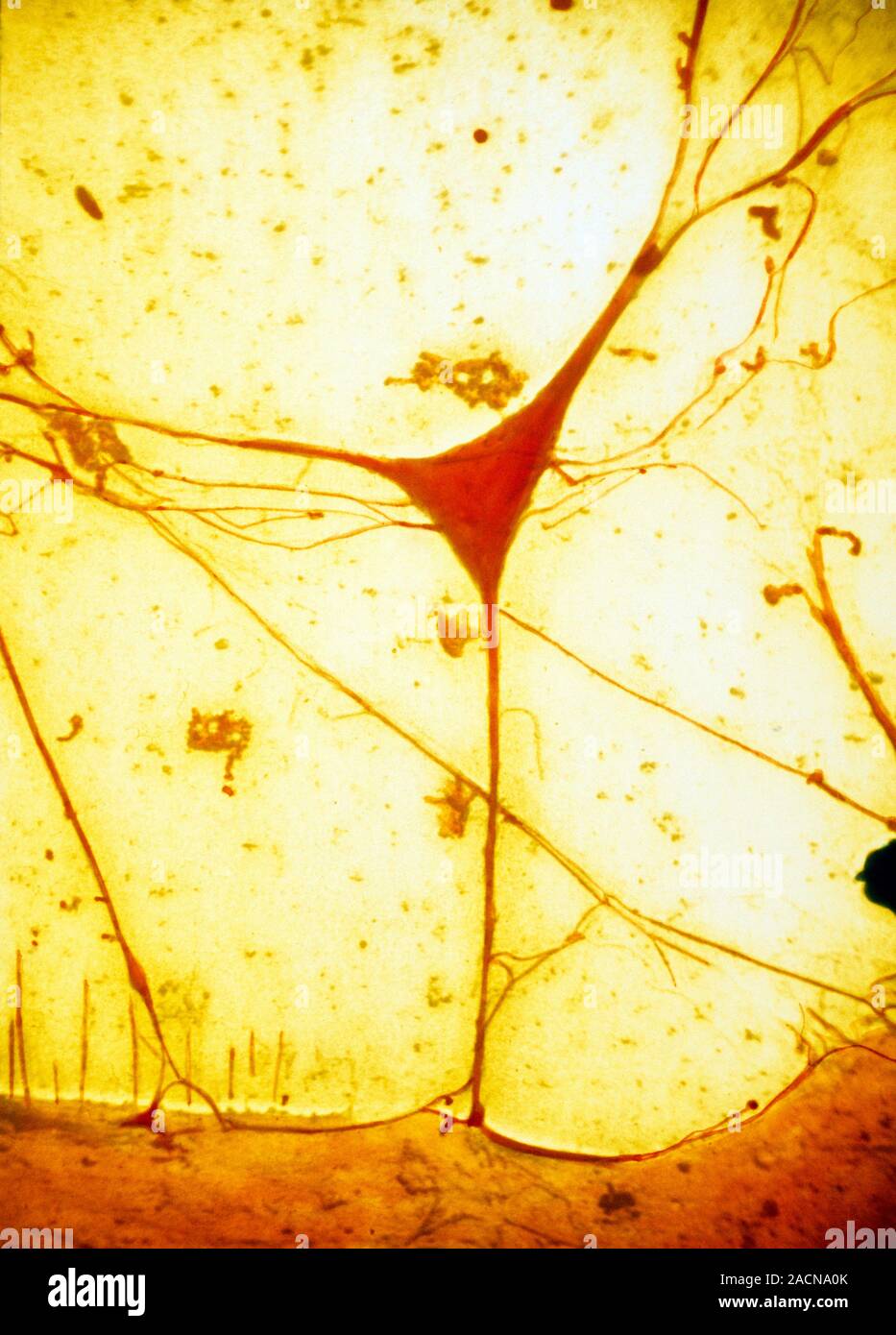 Nerve cell. Coloured scanning electron micrograph (SEM) of a nerve cell ...