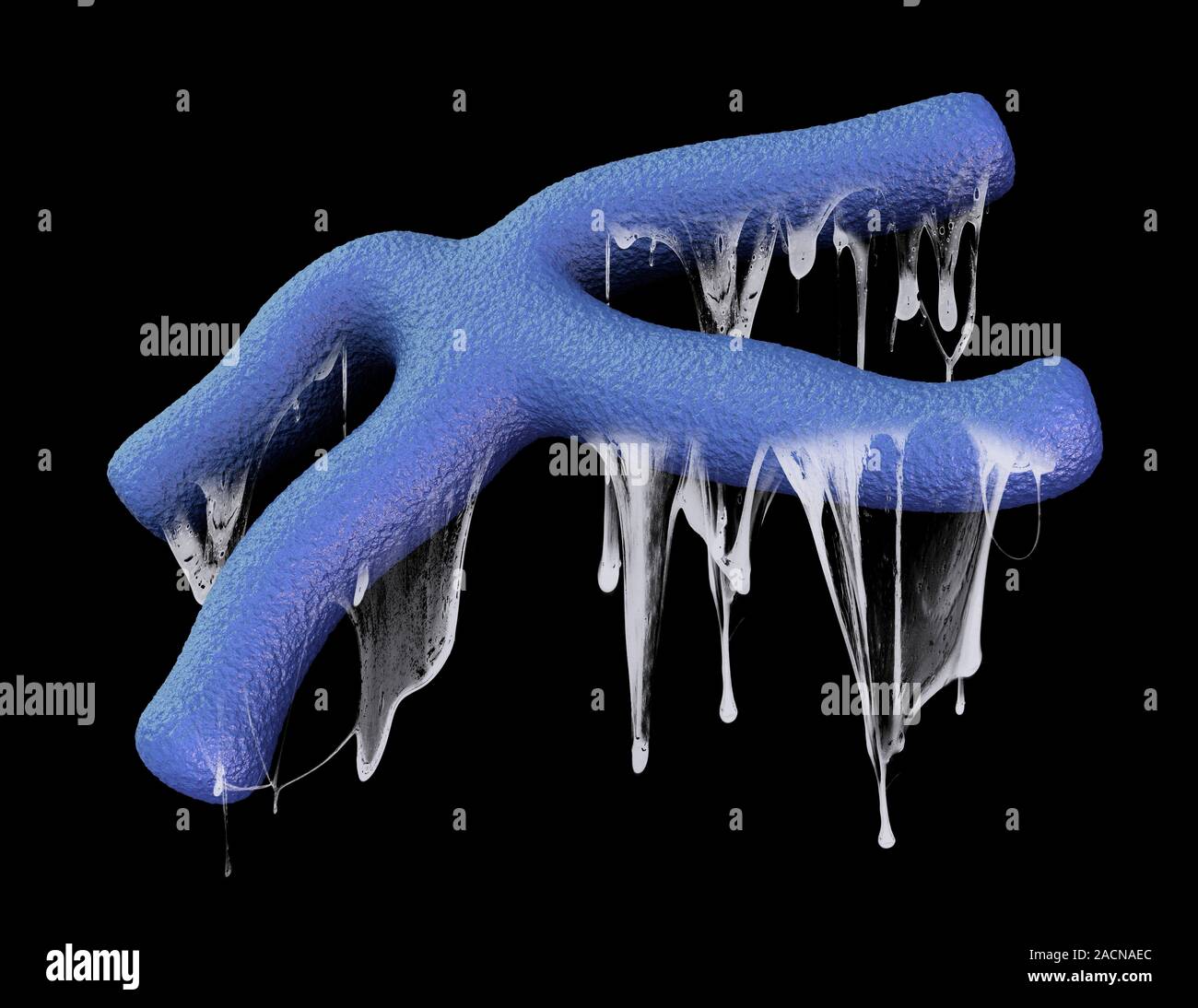 Damaged chromosome, conceptual computer artwork. Chromosomes are ...