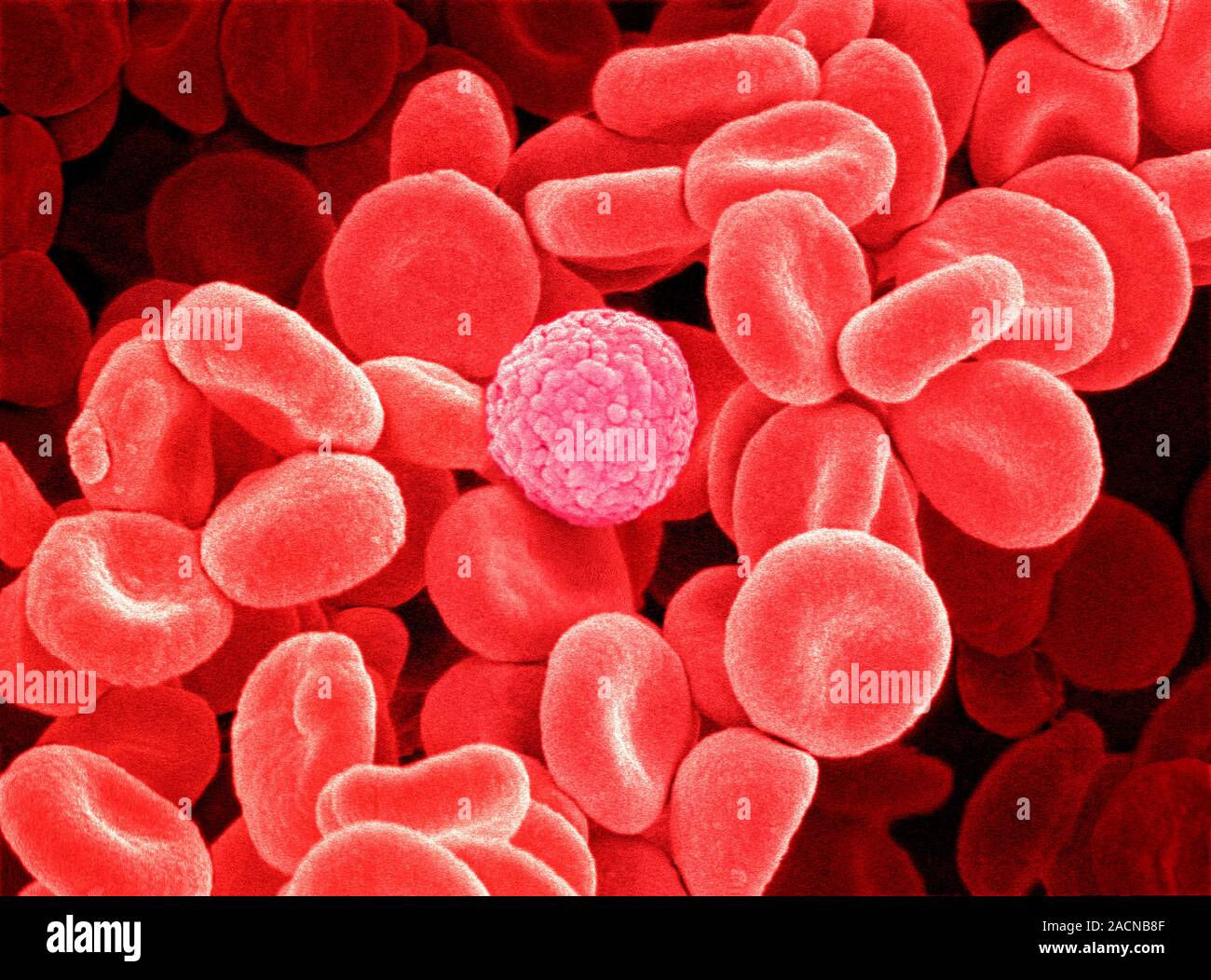 Blood cells. Coloured scanning electron micrograph (SEM) of human red ...