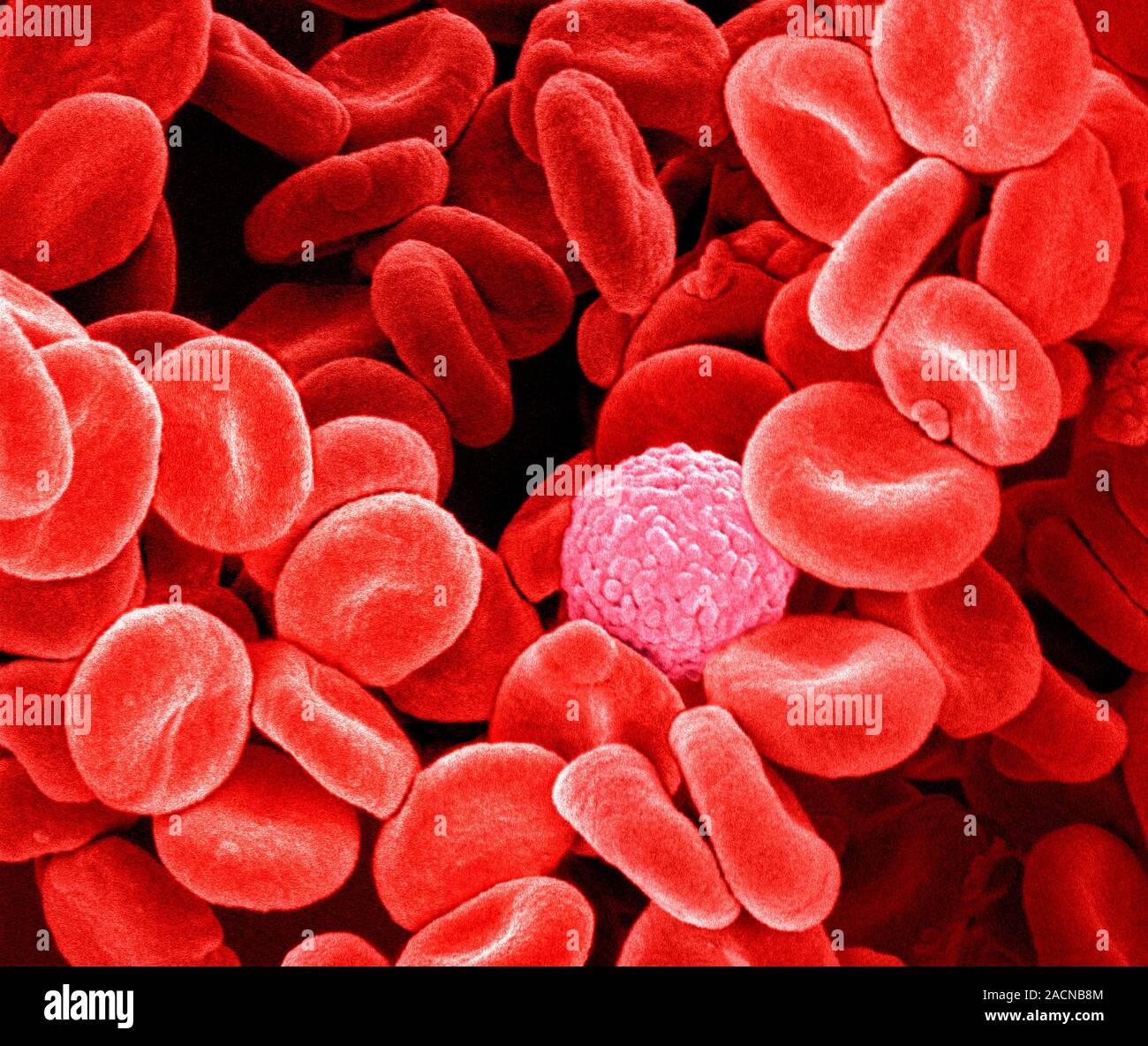Blood cells. Coloured scanning electron micrograph (SEM) of human red ...