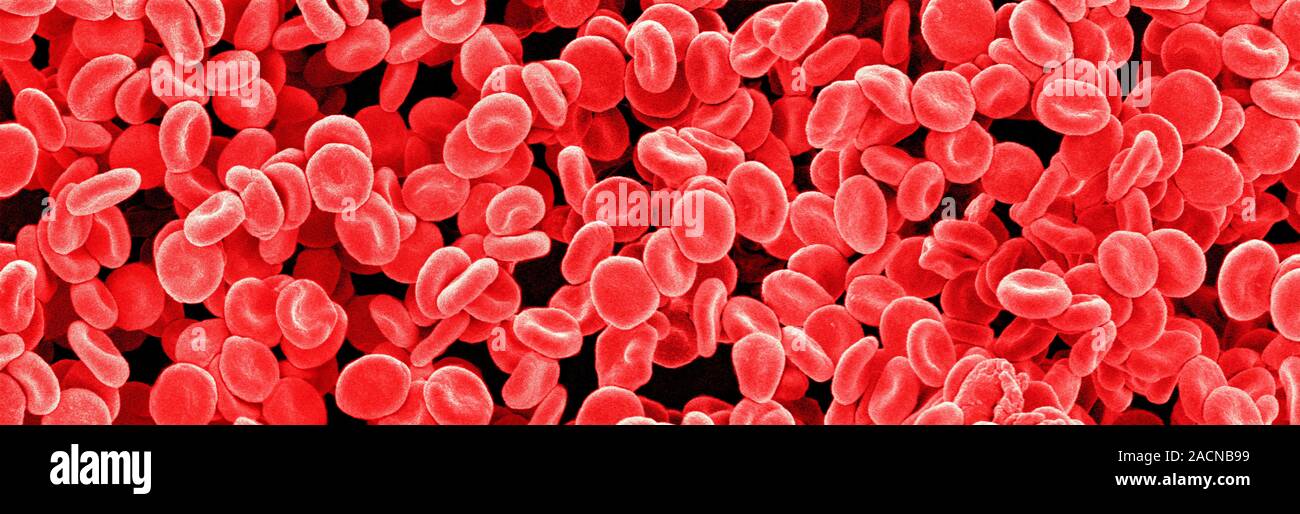 Red blood cells. Coloured scanning electron micrograph (SEM) of human ...