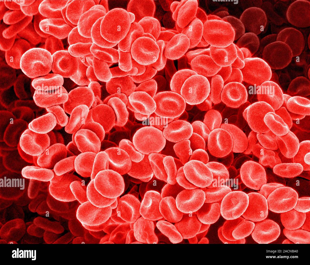 Red blood cells. Coloured scanning electron micrograph (SEM) of human ...