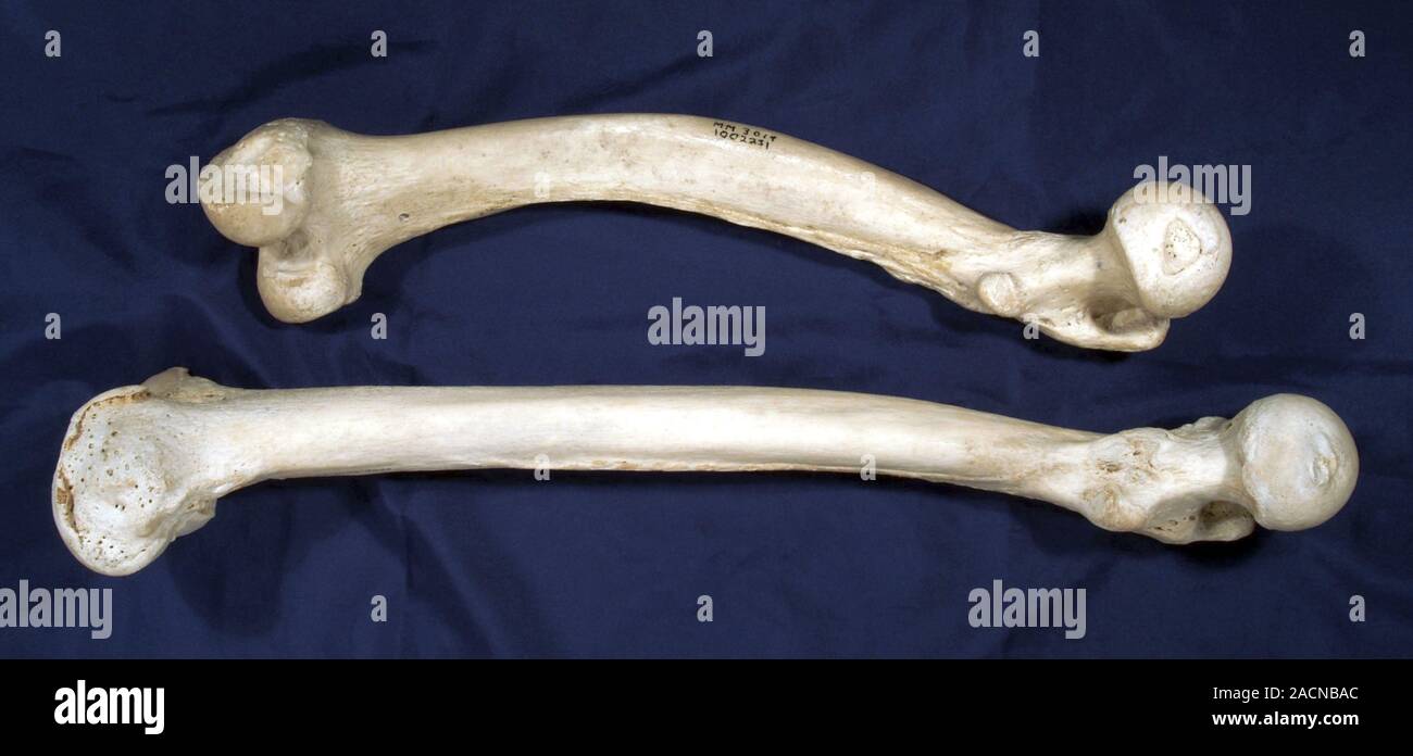 Femurs