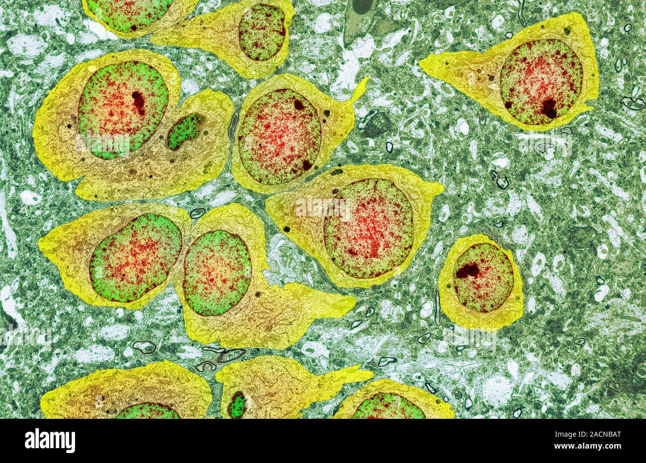 Brain nerve cells. Transmission electron micrograph (TEM) of a section ...