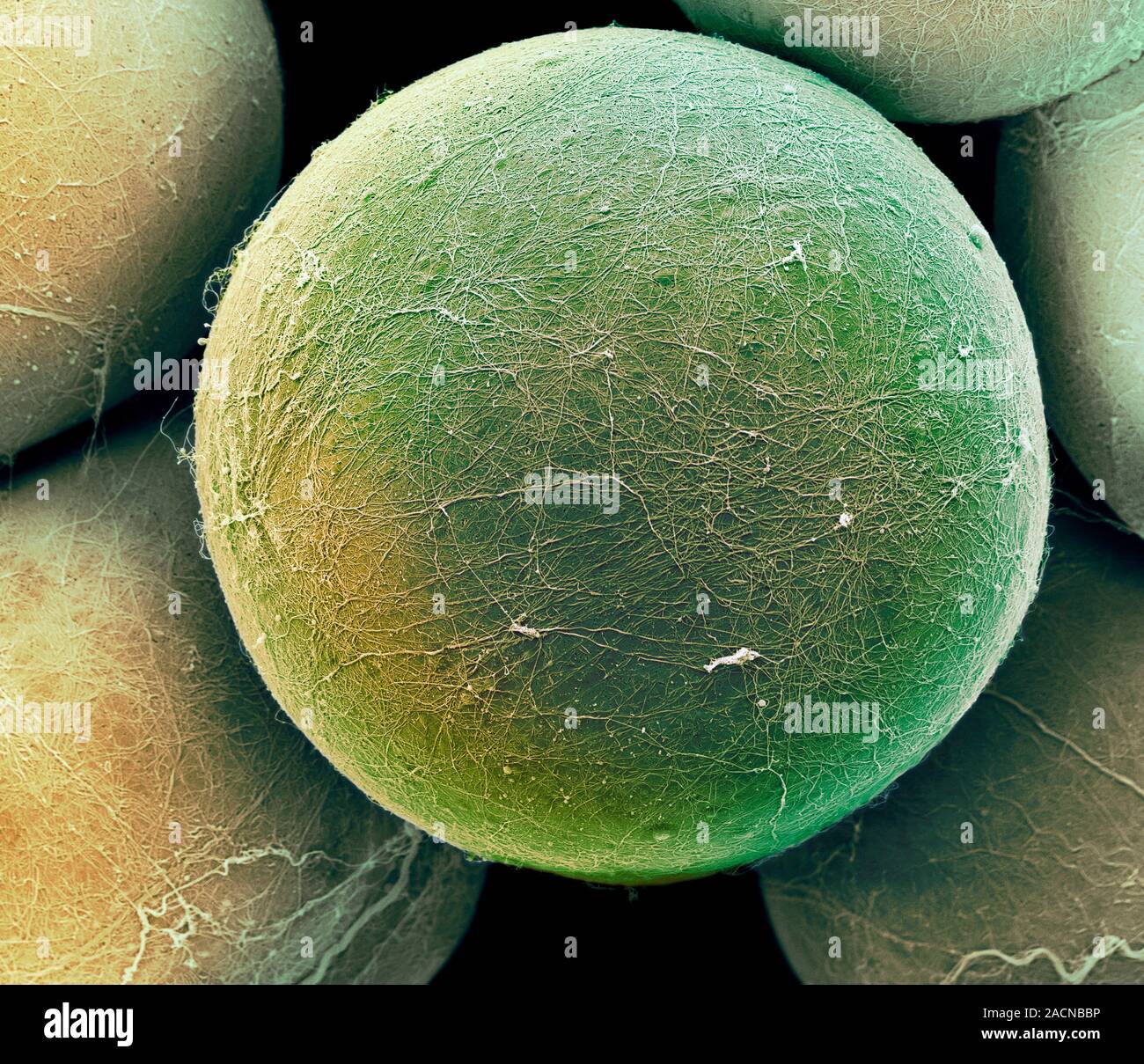 Fat cells. Coloured scanning electron micrograph (SEM) of adipocytes ...