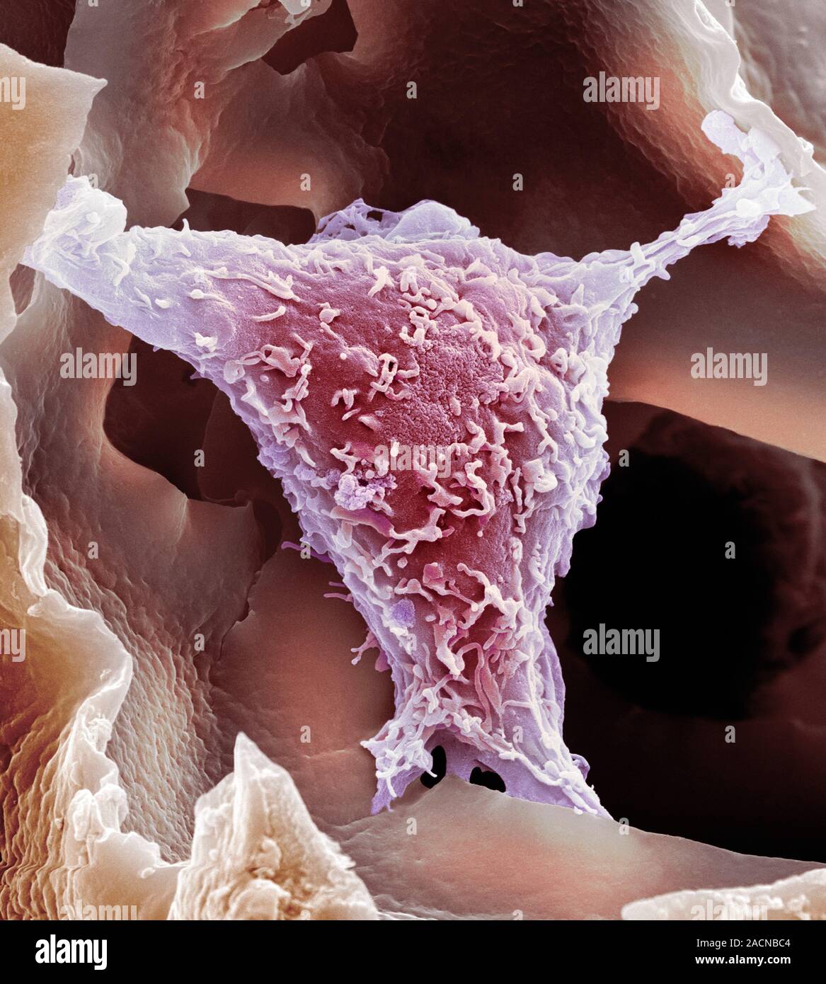 HeLa cell. Coloured scanning electron micrograph (SEM) of a HeLa cell ...
