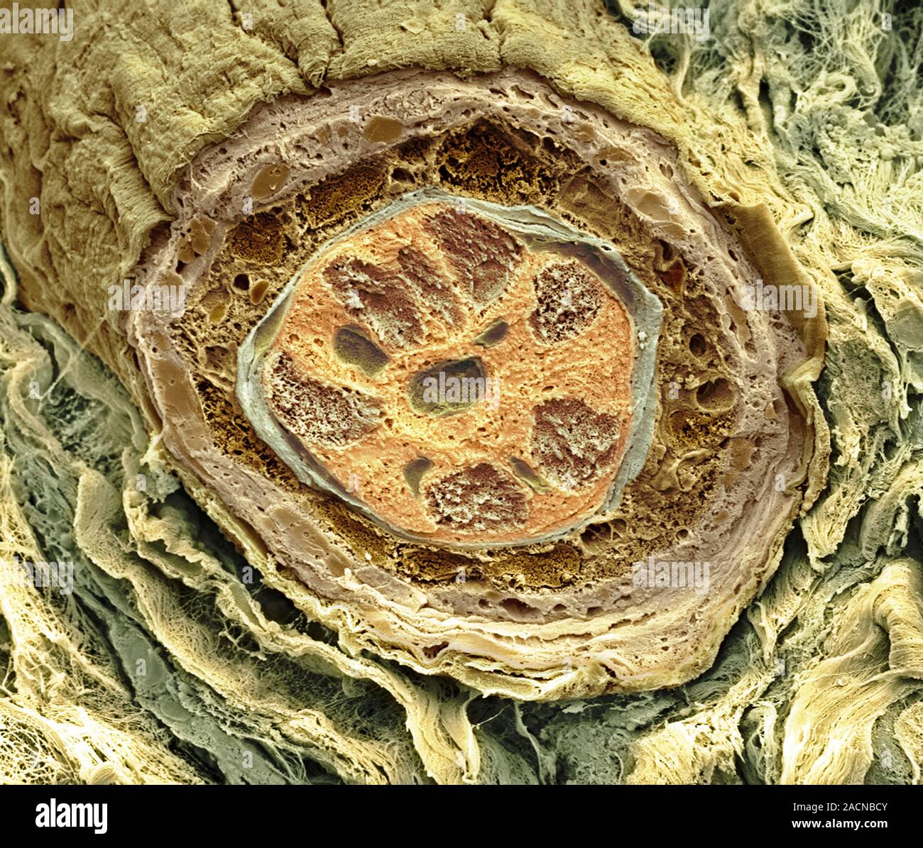 Hair follicle. Coloured scanning electron micrograph (SEM) of a section ...